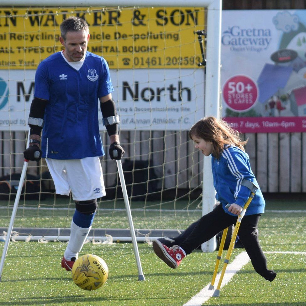 Amputee football comes to Scotland for first time - BBC News