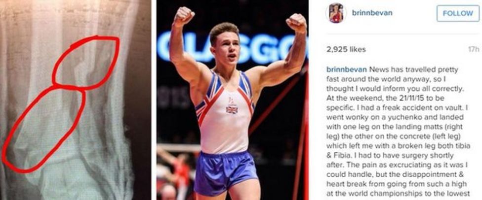Gymnast Brinn Bevan breaks leg to put Rio 2016 hopes in doubt - BBC Sport