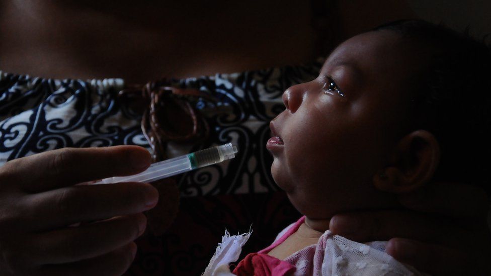 Microcephaly in Brazil: The battle to survive the first year - BBC News