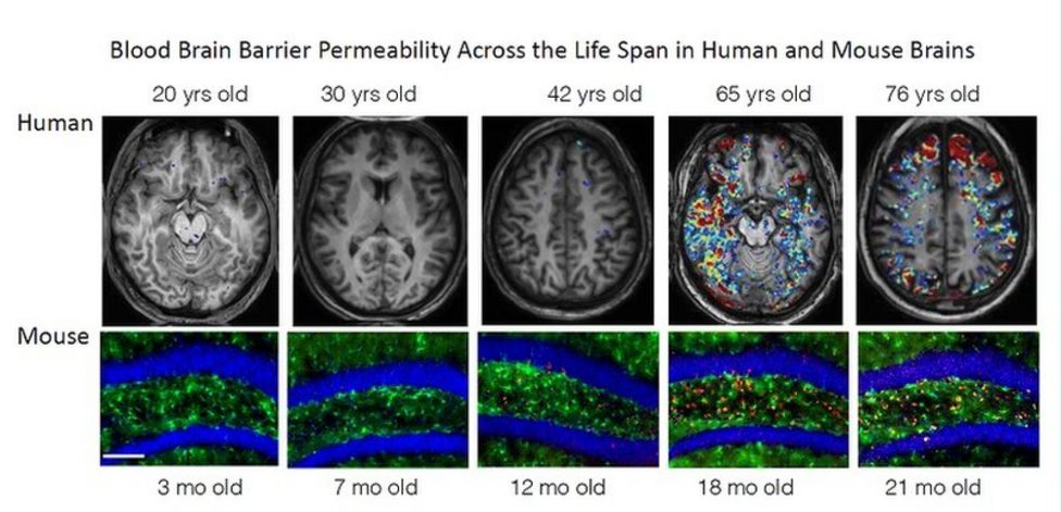 Chemicals 'repair damaged neurons in mice' - BBC News