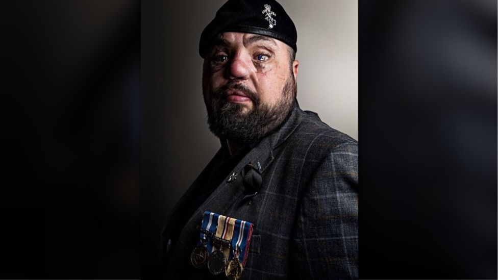 Morley: Veteran shot by sniper to join march at Cenotaph - BBC News