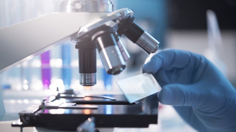 Smear test recalls after out-of-date vials error - BBC News