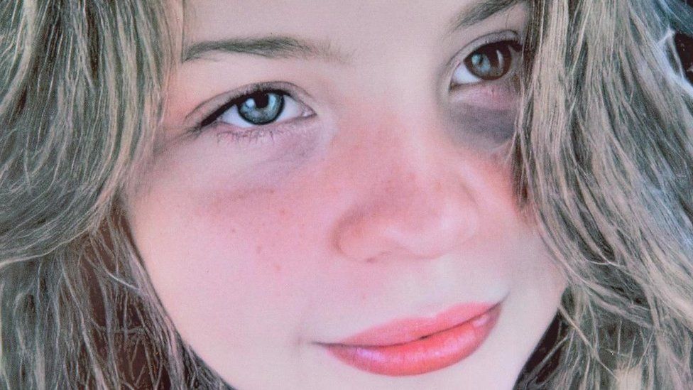 Mental Illness Saddest Case Of Woman Sent To Prison Not Hospital