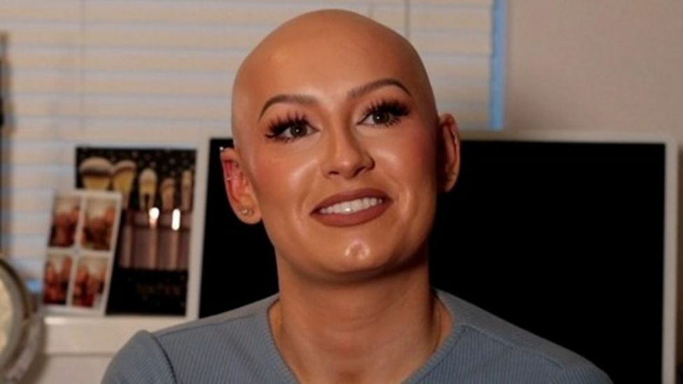 Alopecia: 'It takes a bit more courage to get on stage' - BBC News