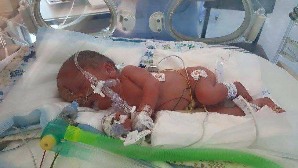 Breast cancer: Terminally-ill mother prepares her young family for her ...