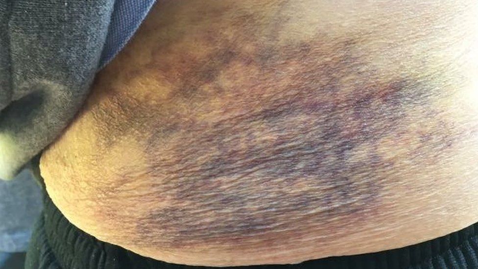 Latimer Grange home 'humiliated' deafblind dementia patient - BBC News