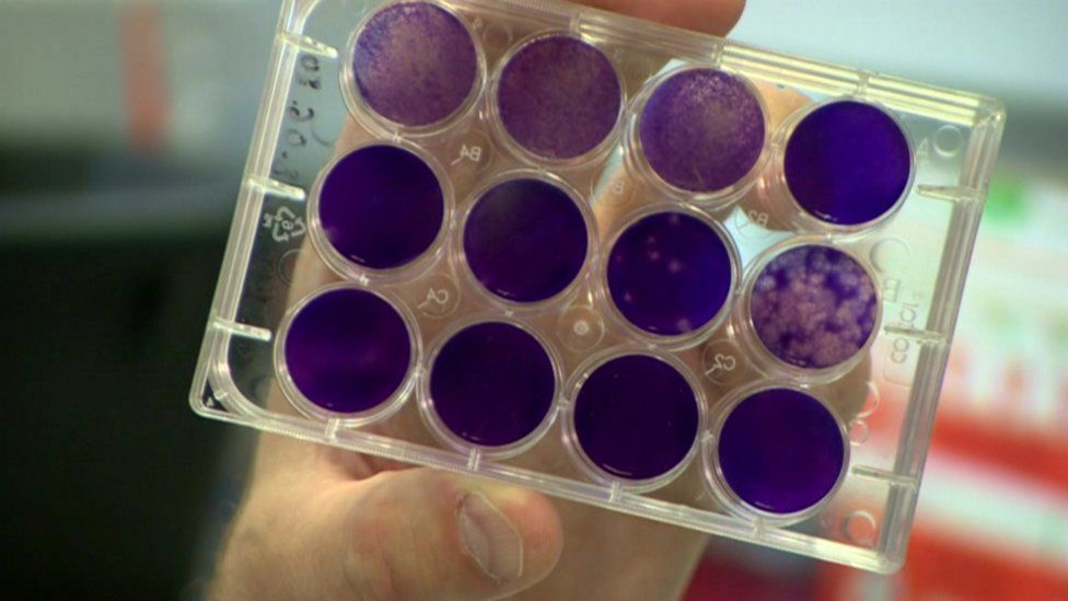 Coronavirus: Covid-19 samples tested in Belfast laboratory - BBC News