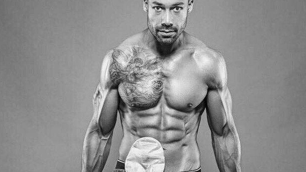 Model with no bowel denied toilet access in Manchester - BBC News