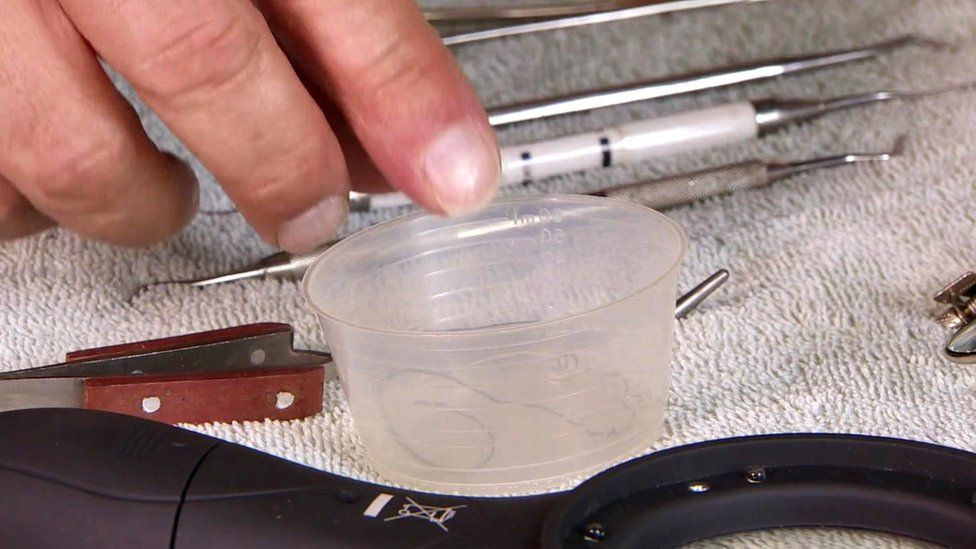 Lancashire man performs DIY operation on himself to remove suture - BBC ...