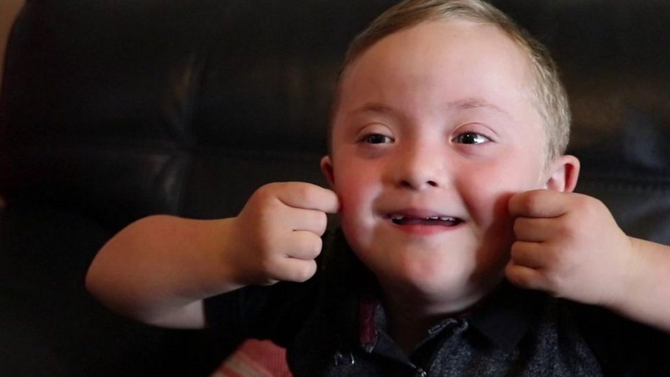 Store praised for helping boy with genetic disorder - BBC News