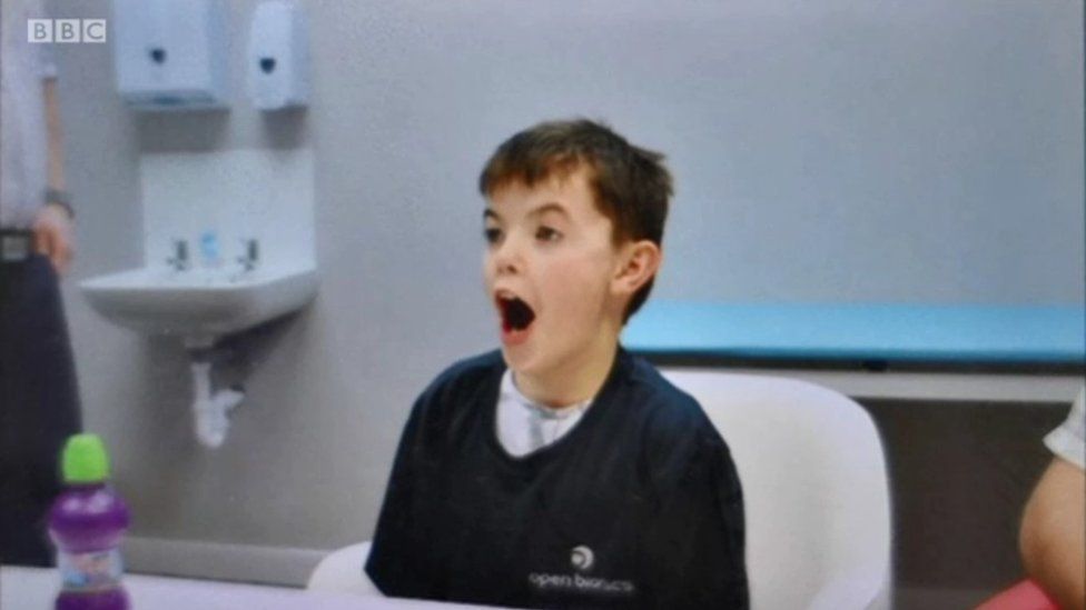 Edinburgh boy gets bionic hand for Christmas - BBC News
