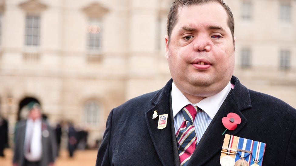 Blind Morley veteran to share rehab tips with US - BBC News