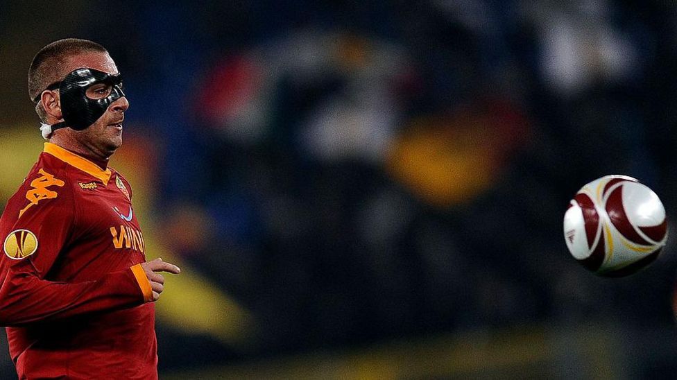 Kylian Mbappe: 11 iconic images of great players in masks - BBC Sport