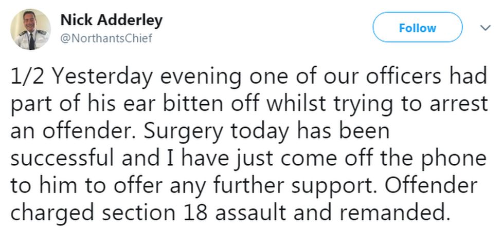 Northamptonshire Police officer has ear 'bitten off' in attack - BBC News