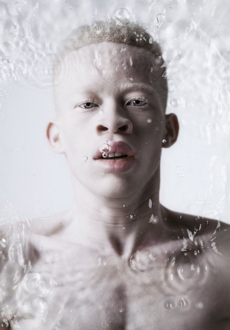 In pictures: Albinism and perceptions of beauty - BBC News
