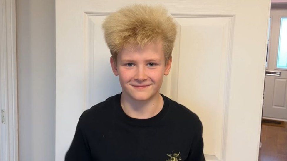 Woman gets uncombable hair syndrome diagnosis after radio interview ...