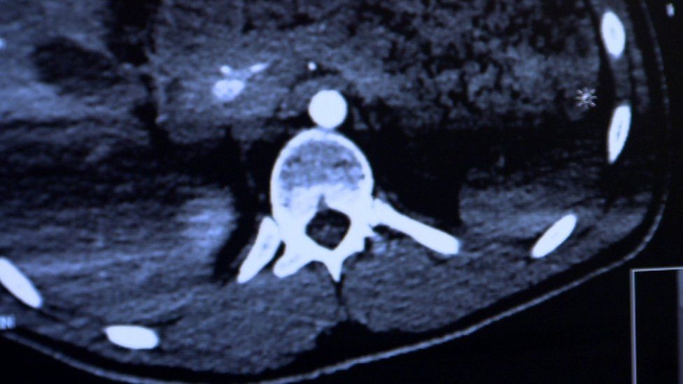 Former surgeon speaks about treating victims of paramilitary-style ...