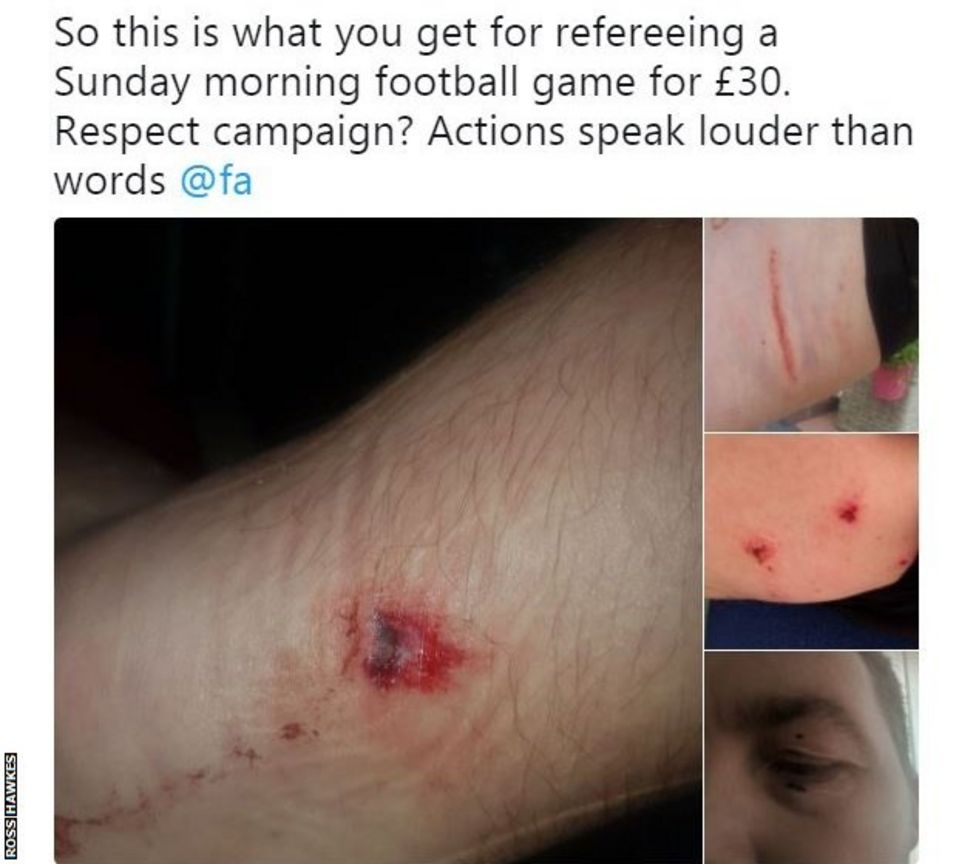 Sunday morning football referee quits after alleged assault by player ...