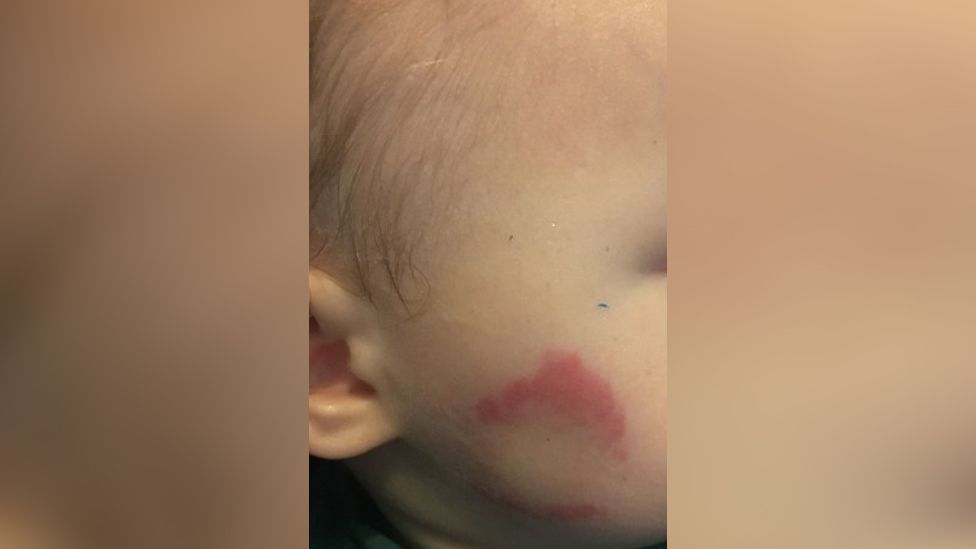 Wellingborough man admits biting toddler's face - BBC News