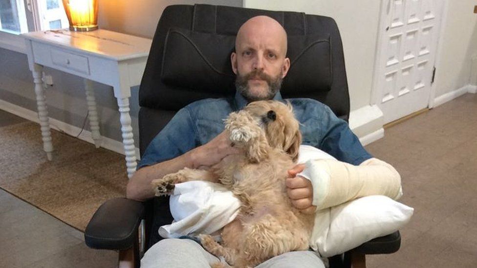 Harry Potter actor Jim Tavare is back home after breaking his neck in a ...
