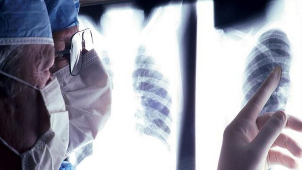 Web databases hit in ransom attacks - BBC News