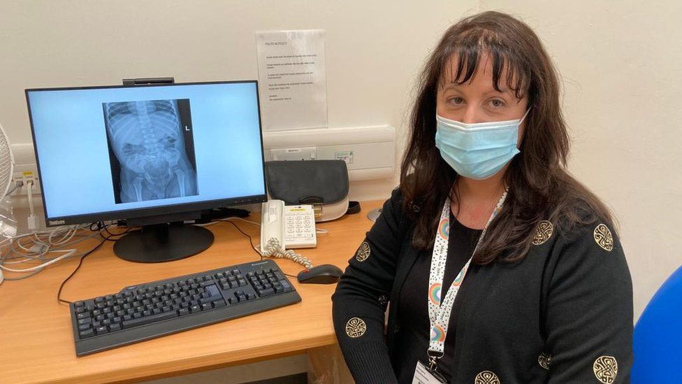 Stevenage mum's warning after two-year-old swallows magnets - BBC News