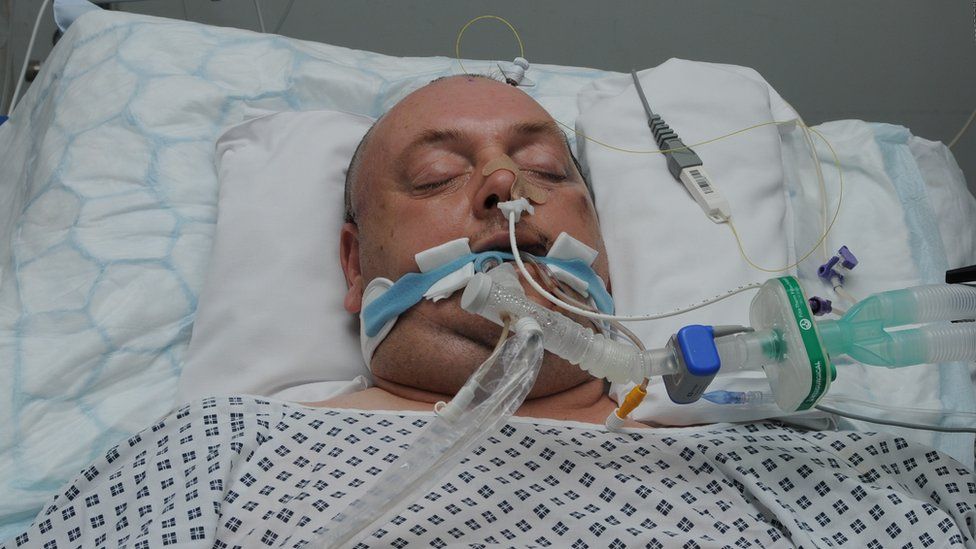 Bride-to-be's plea after dad is left in coma on stag do - BBC News