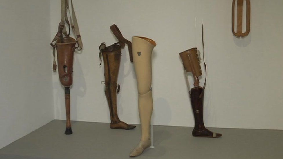 Leeds display explores sculptors' role in prosthetics development - BBC ...