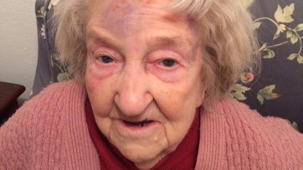 Gran, 87, has wedding ring stolen in Stretford burglary - BBC News