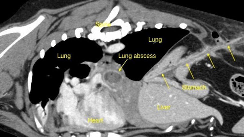 Vets save kebab stick-eating dog on diet - BBC News