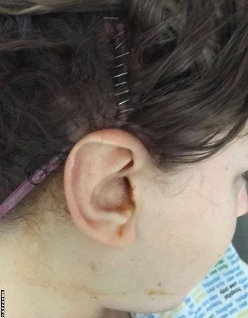 Judy Humber: The martial artist who is fighting again after a fractured ...