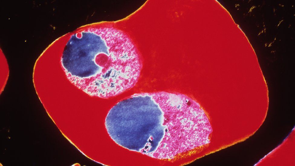 Drug-resistant malaria can infect African mosquitoes - BBC News