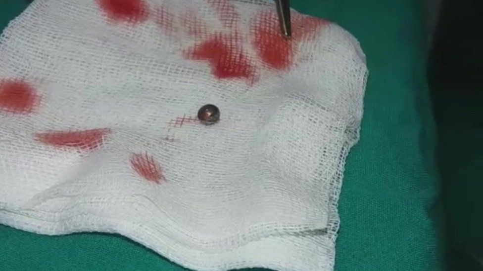 Reporting Syria's war - the images you won't see - BBC News