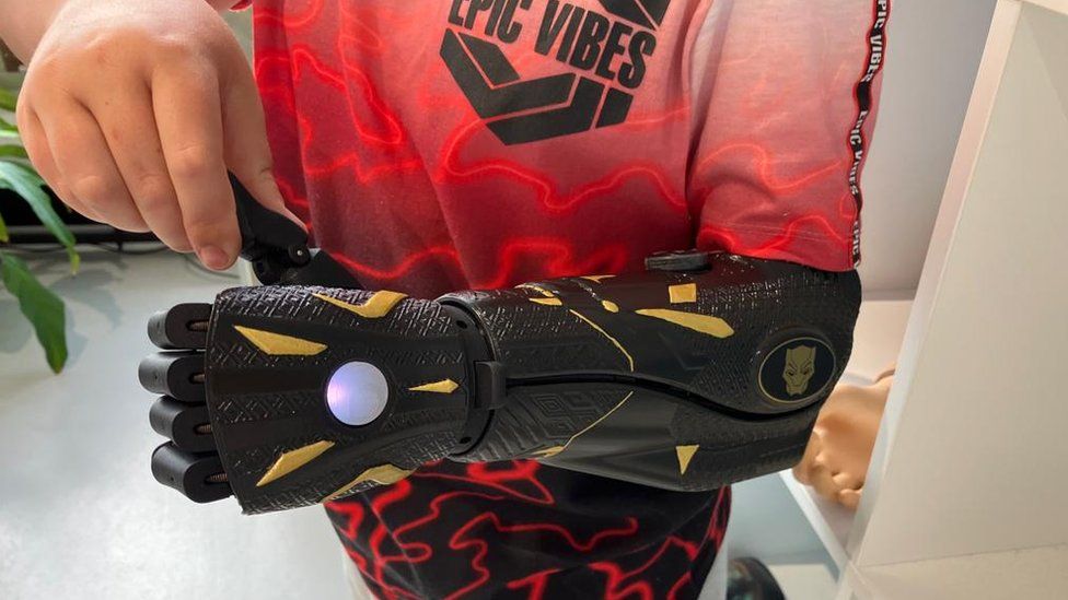 New bionic arm 'absolutely life-changing' for boy from Bude - BBC News