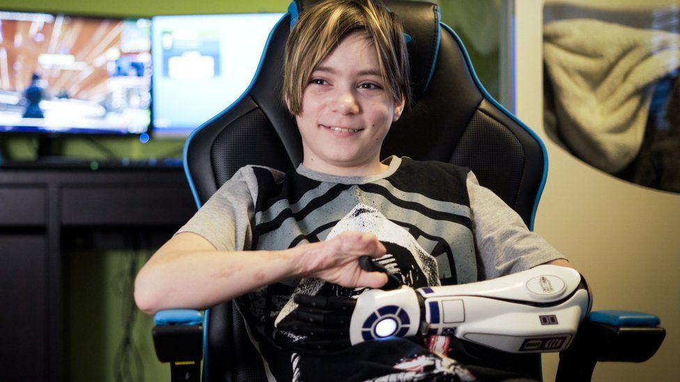 Star Wars: 11-year-old fan gets special R2D2 bionic arm - BBC Newsround