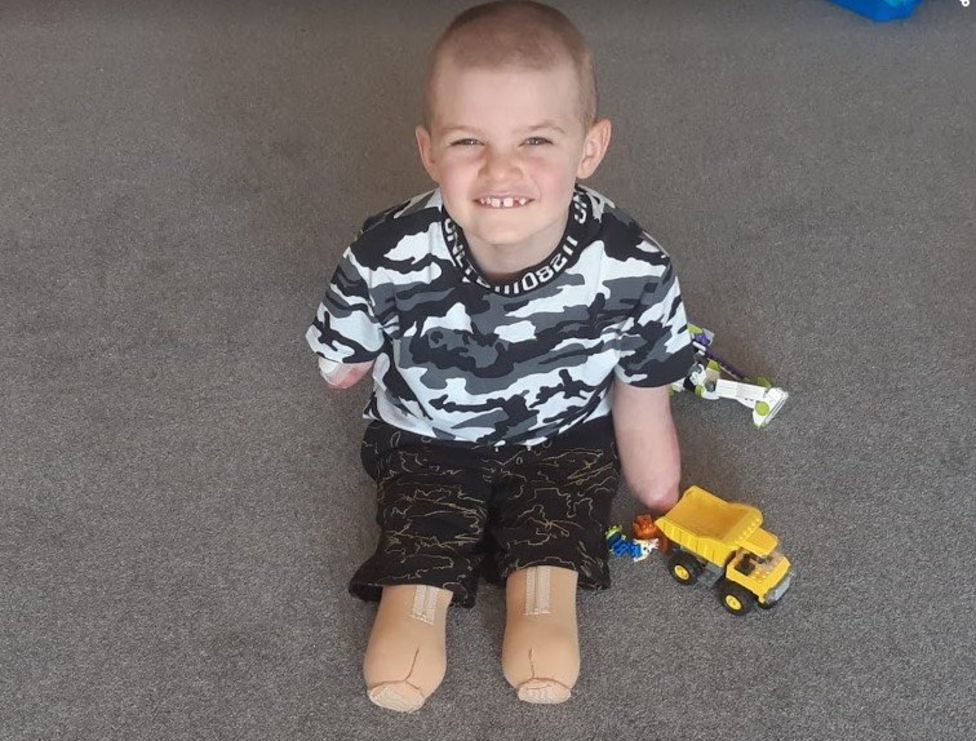 Luke Mortimer: Skipton boy who lost limbs to meningitis back home - BBC ...