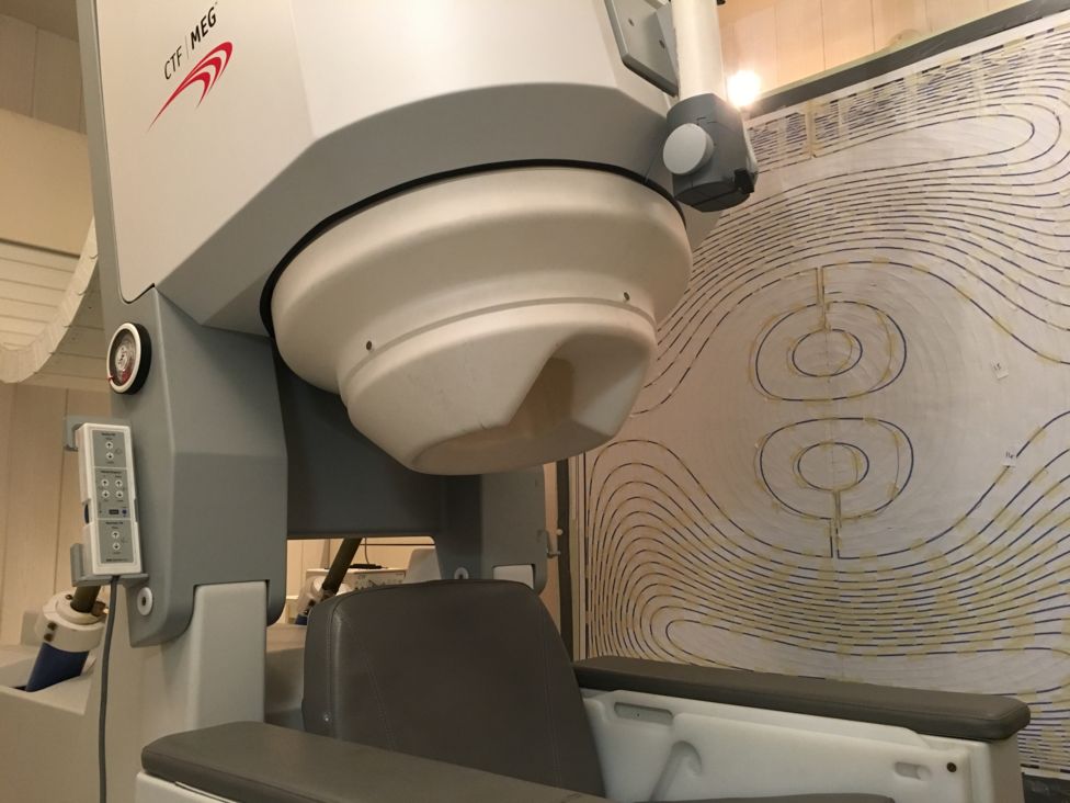 The wearable brain scanner you can move around in - BBC News