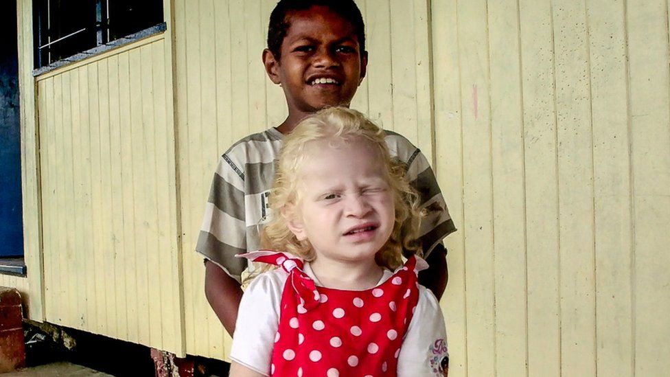Film highlights Fiji's baffling rate of albinism - BBC News