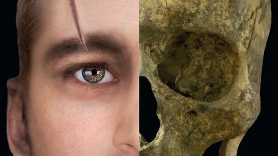 Research sheds new light on ancient bones found at Cramond - BBC News