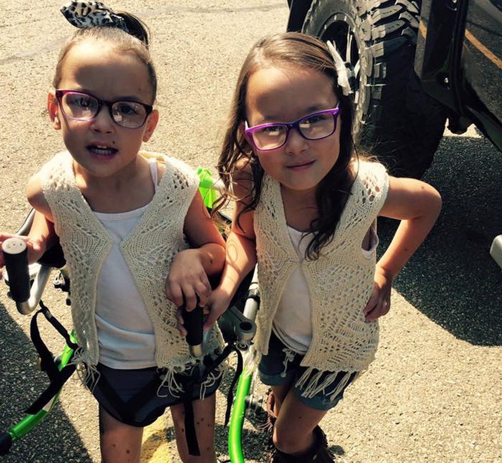 Long-lost siblings find niece in Canada has rare tumour - BBC News