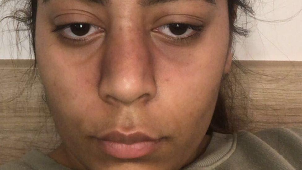 Birmingham: Student nurse's 'pride' to share headbutt ordeal - BBC News