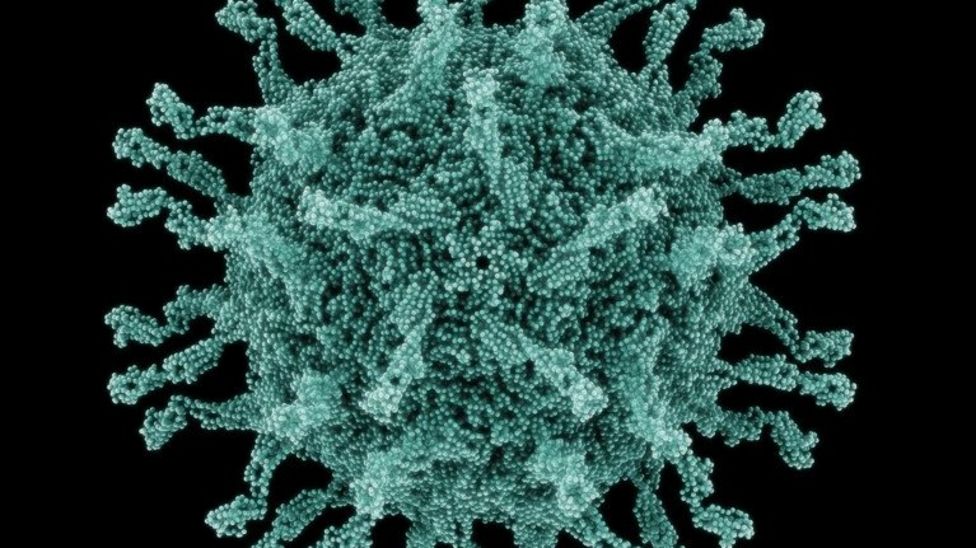 'Up to 12,000' people suffer post-polio effects in Wales - BBC News