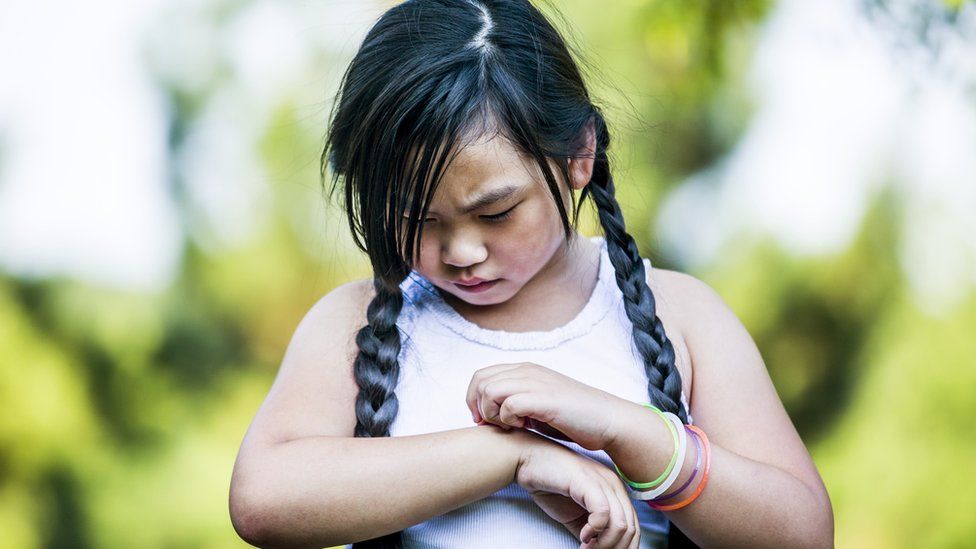 Itching: Scientists discover what makes our skin itch - BBC Newsround