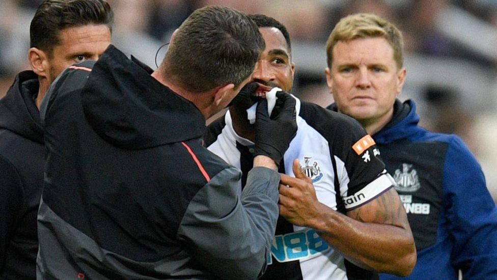 Newcastle: 'It wasn't as bad as it looked' - Wilson on tooth - BBC Sport