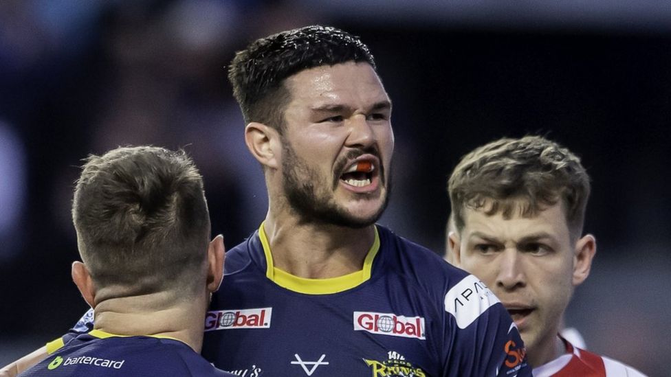 James Bentley: Leeds Rhinos star gets all-clear after injury scare ...