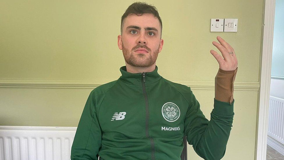 Londonderry: Caw roundabout safety calls after bus crash - BBC News