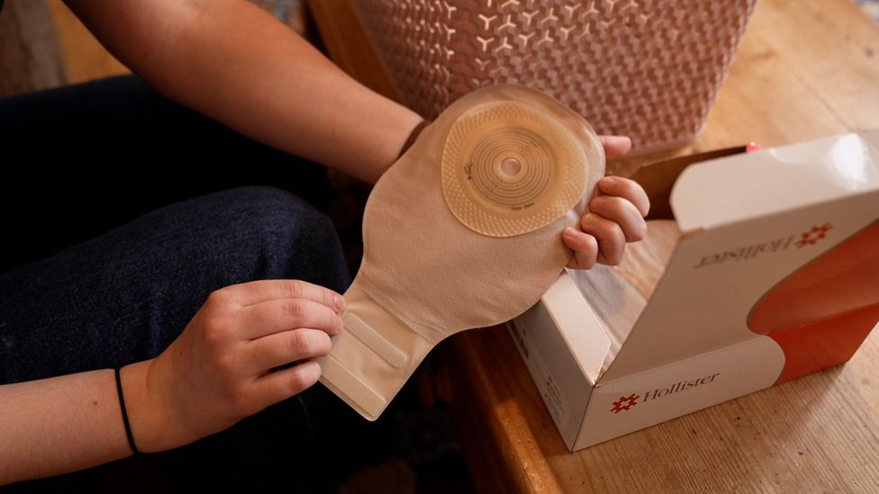 Stoma: Teen's 'period pain' turn out to be ulcerative colitis - BBC News