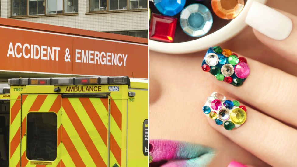 Cambridgeshire A&E 'not for hiccups and broken nails', clinicians warn ...