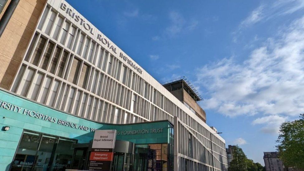 End doctors' pay dispute, says Bristol's hospital boss - BBC News