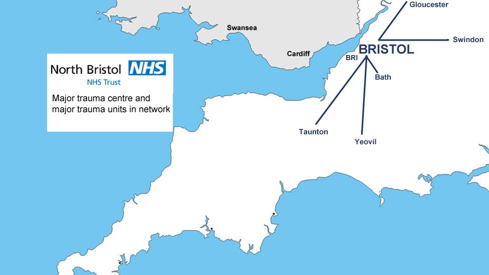How Bristol's major trauma centre works - BBC News